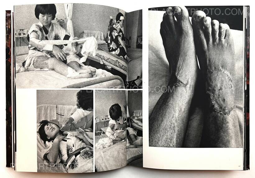 Ken Domon: Hiroshima (Signed), Kenko-Sha, 1958 | Bookshop Le Plac'Art Photo